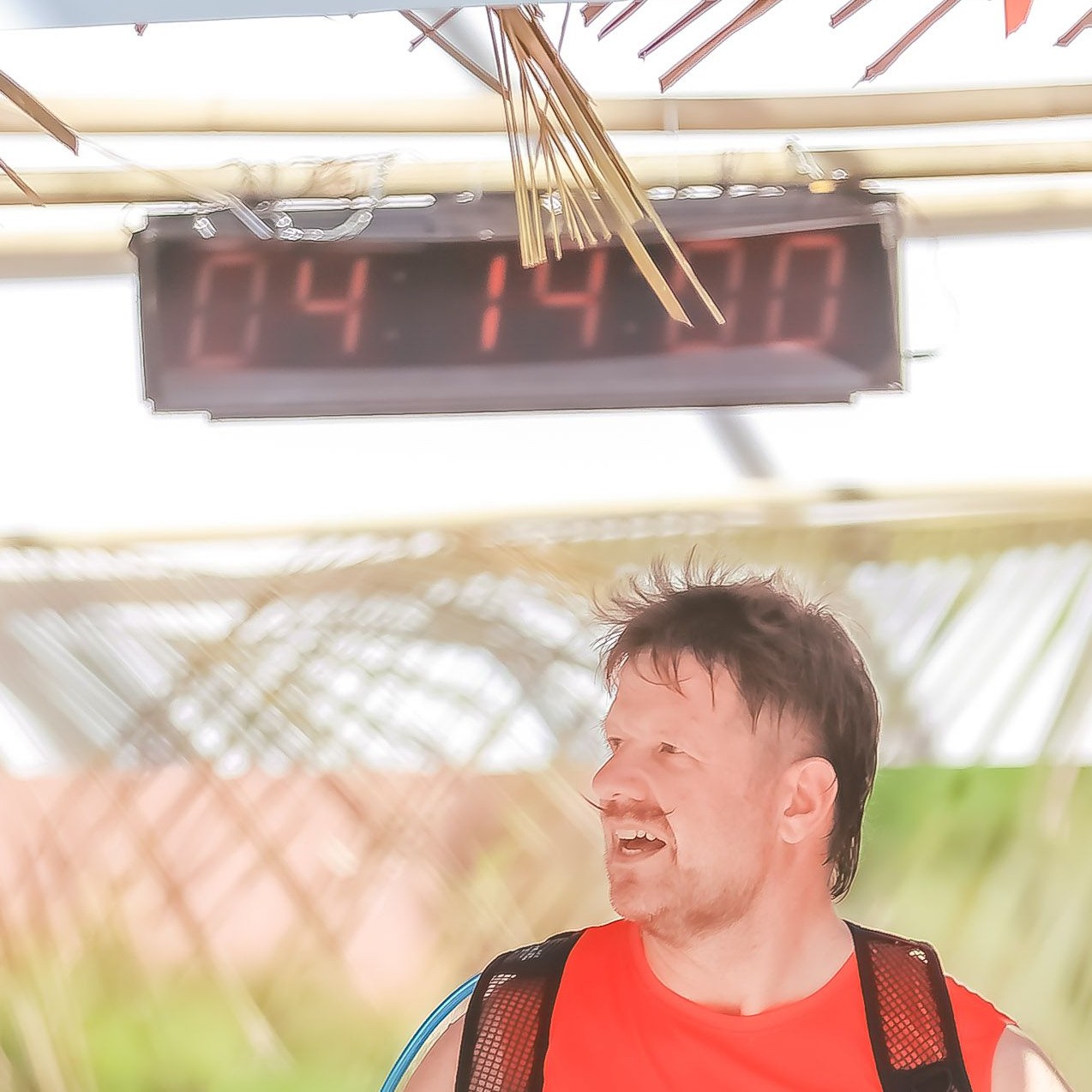 The full extent of my injuries | Micah Woods: the official site